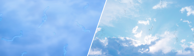 What Are Eye Floaters | Causes, Symptoms & Treatment